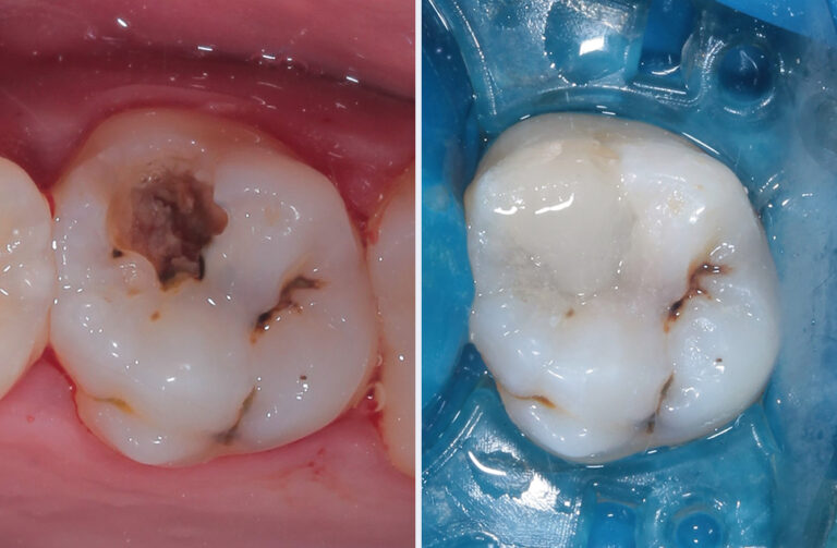nos traitements dentaires - ORALYS - Cabinet dentaire de groupe