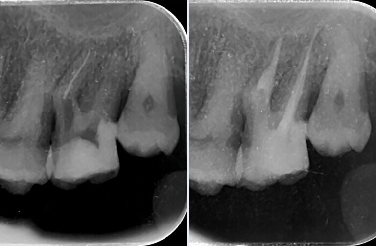 nos traitements dentaires - ORALYS - Cabinet dentaire de groupe